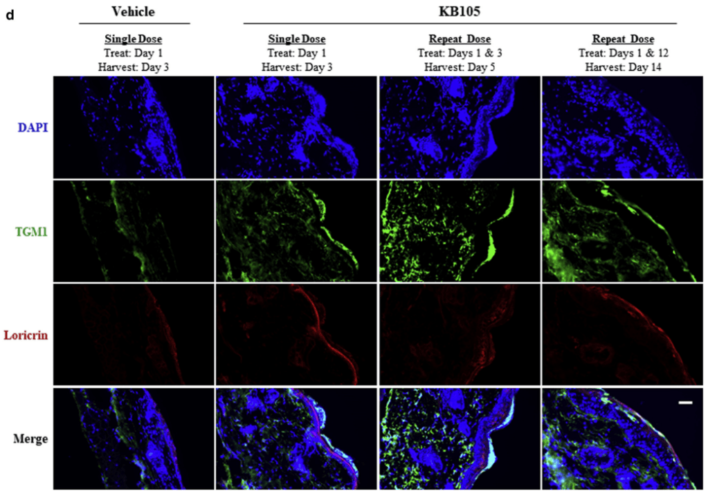 BIOTECH (101) Krystal Biotech: Redosable HSV-1 vector gene therapy ...